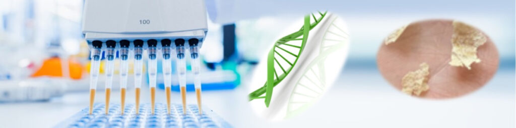 Streamlined Genomic DNA Extraction from Dandruff